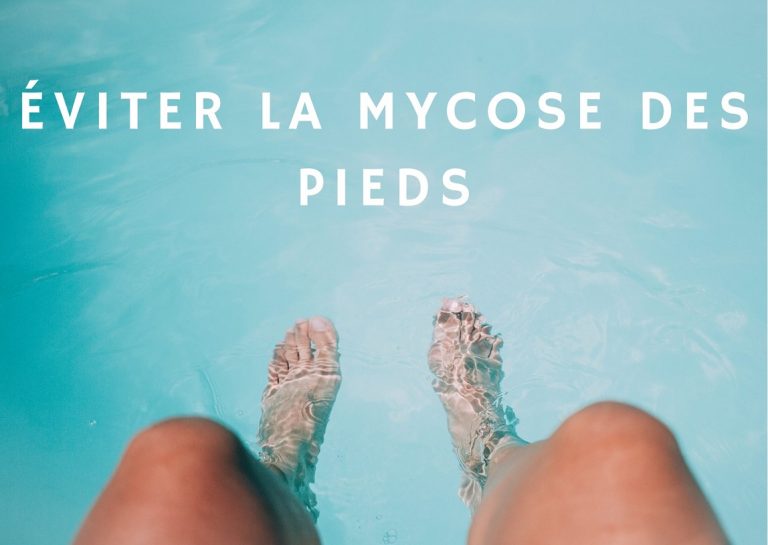 Mycose pied : une infection fongique des pieds